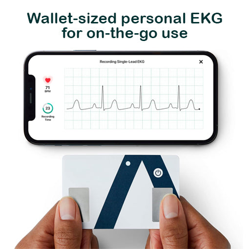Personal Mobile EKG Monitor